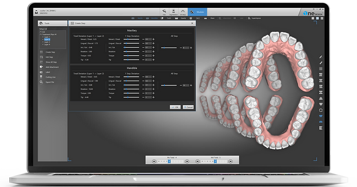 dentOne - clearaligner / 3D Orthodontic Software